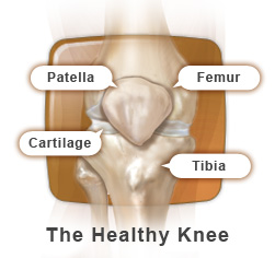 Knee Replacement Surgery :: South Arkansas Orthopaedics & Sports Medicine
